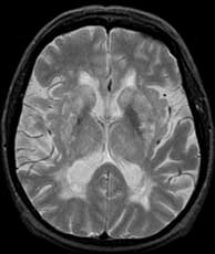 Neuroradiology Reading Room: Dx