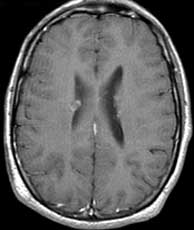 Neuroradiology Reading Room: Dx