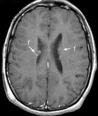 Neuroradiology Reading Room: T1 ax post