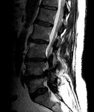 Neuroradiology Reading Room: Dx